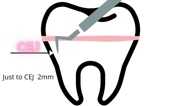 How to Calculate CAL – RDHopes.com