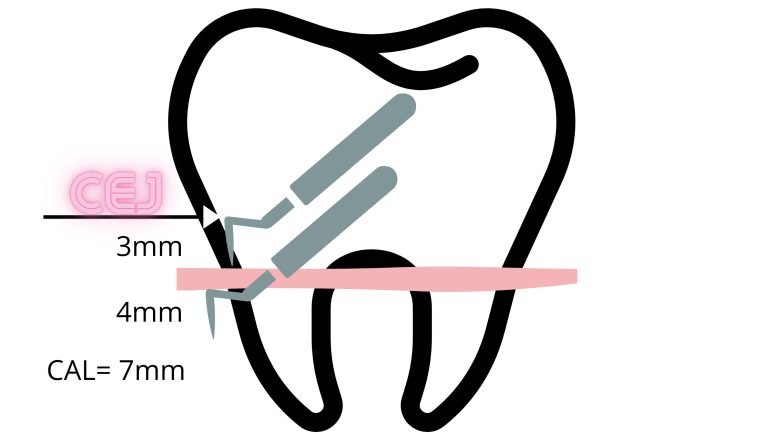 How to Calculate CAL – RDHopes.com