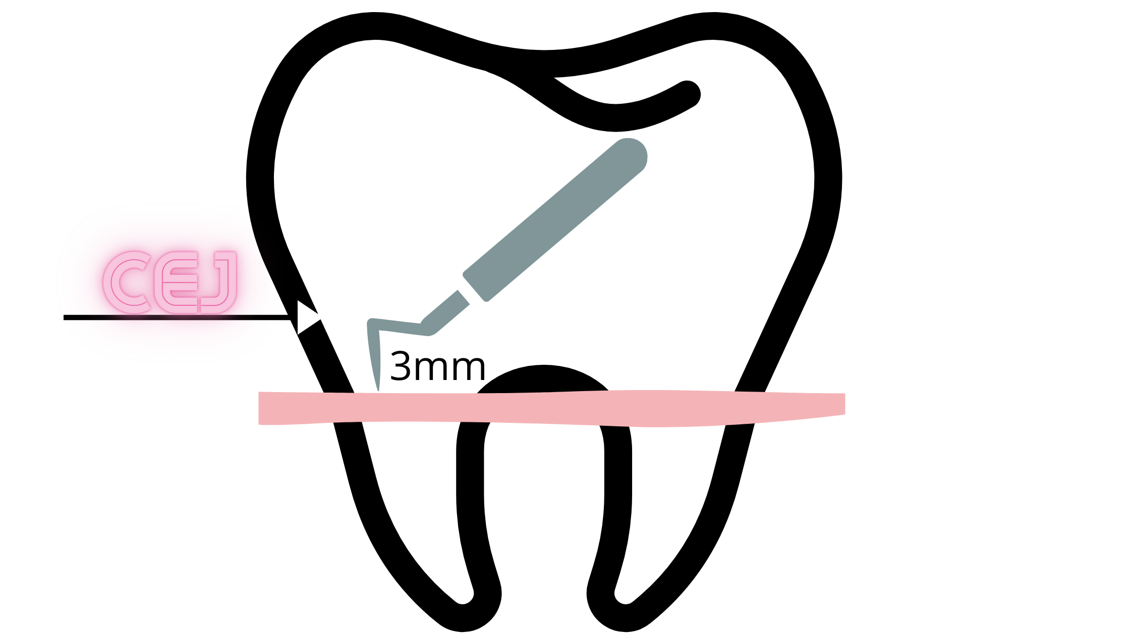 How to Calculate CAL – RDHopes.com
