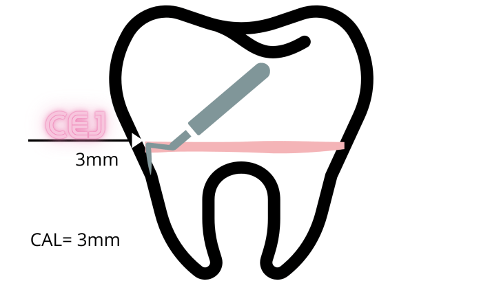 How to Calculate CAL – RDHopes.com